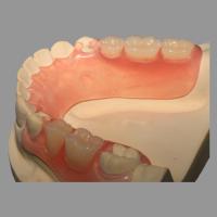 China Dental Lab Crown |  Casting Pink TCS Flexible Partials With Excellent Retention for sale