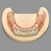 China Dental Lab Crown |  Casting Pink TCS Flexible Partials With Excellent Retention for sale