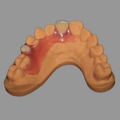 China Natural Looking Valplast Flexible Partial Adjustable Fracture Resistant for sale