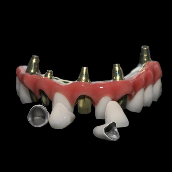 Quality Dental PFM Crown And Bridge Customizable With CoCr Ceramic Materials for sale
