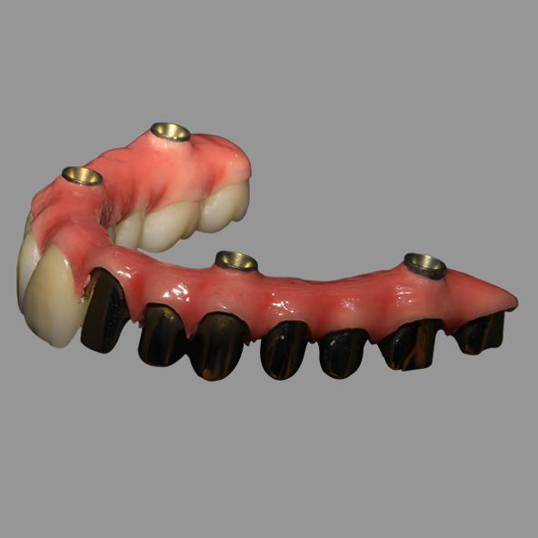 Quality Class 2 Hybrid Malong Full Arch AOX Implant Bridge Titanium Bar with Full Solid for sale