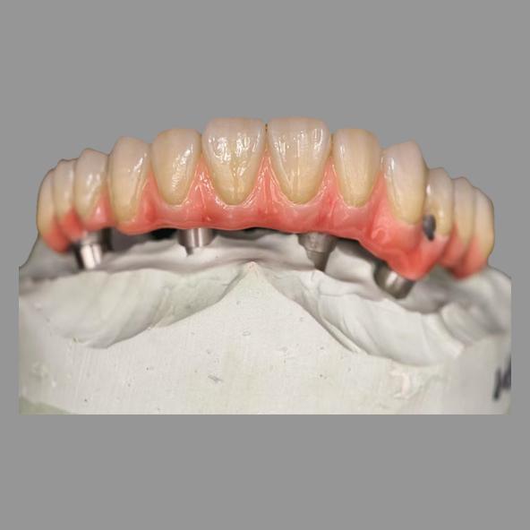 Quality Class I AOX Implants All On 4 Hybrid Titanium Screw Retained Full Zirconia for sale