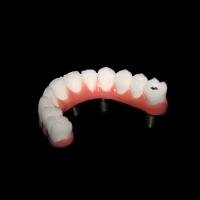 Quality AOX Class I All On 4 Dental Implants Hybrid Titanium Screw Retained PFM for sale