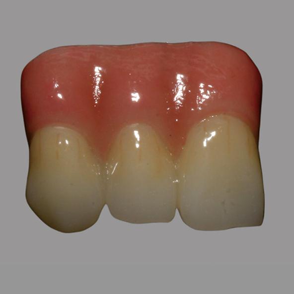 Quality CAD / CAM Dental Layered Zirconia Bridge With Pink Porcelain for sale