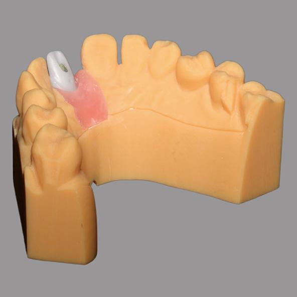 Quality White Custom Zirconia Abutment Natural Looking For Dental Restoration for sale