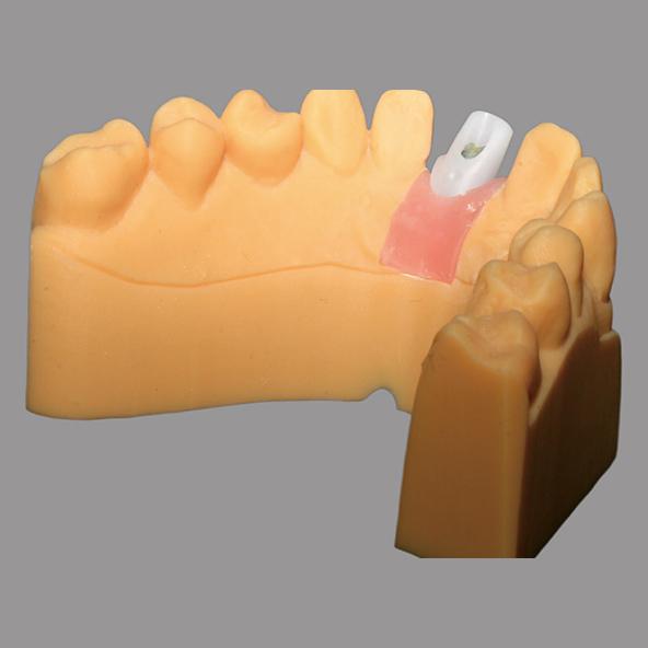Quality White Custom Zirconia Abutment Natural Looking For Dental Restoration for sale