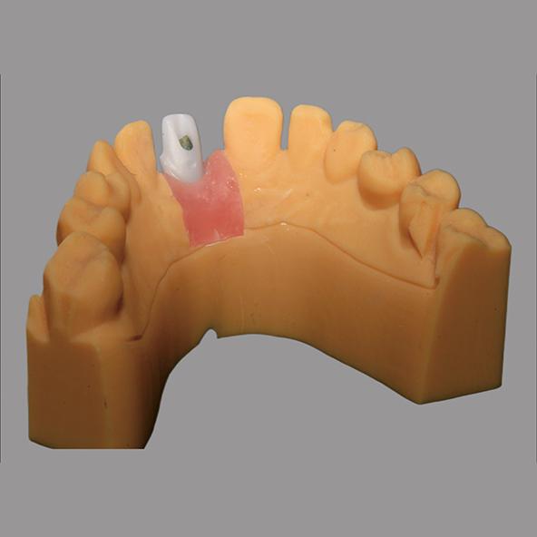 Quality White Custom Zirconia Abutment Natural Looking For Dental Restoration for sale