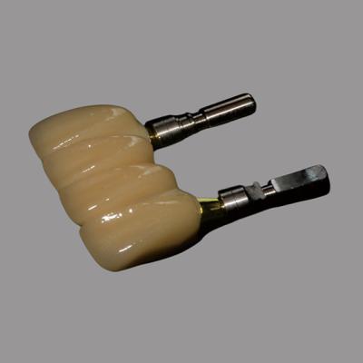 China China Dental Outsourcing | Gold Plating Nitrogen Titanium Abutments Dental Implants Cad/Cam Compatibility for sale