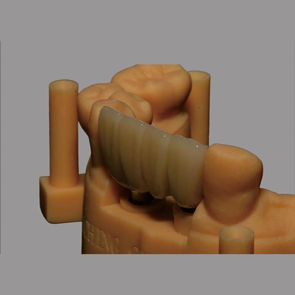 Quality Gold Plating Nitrogen Titanium Abutments Dental Implants Cad/Cam Compatibility for sale