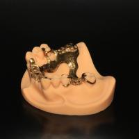 China China Dental Outsourcing | Anodized 3D Printed Titanium Framework Lightweight For Sensitive Skin for sale