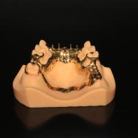 China China Dental Outsourcing | Anodized 3D Printed Titanium Framework Lightweight For Sensitive Skin for sale