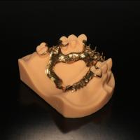 China China Dental Outsourcing | Anodized 3D Printed Titanium Framework Lightweight For Sensitive Skin for sale