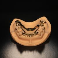 China China Dental Outsourcing | Anodized 3D Printed Titanium Framework Lightweight For Sensitive Skin for sale