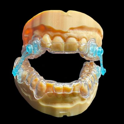 China Anti Snoring Device Dental Occlusal Splint Clear Color Non Invasive for sale