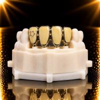 Quality Digital full metal crown CAD CAM - Custom Gold Open-Faced Crown for sale