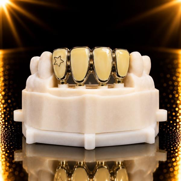 Quality Digital full metal crown CAD CAM - Custom Gold Open-Faced Crown for sale