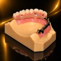 Quality Dental Implant Laboratory | Class 3 Milled Titanium Bar All On X Dental Lmplants for sale
