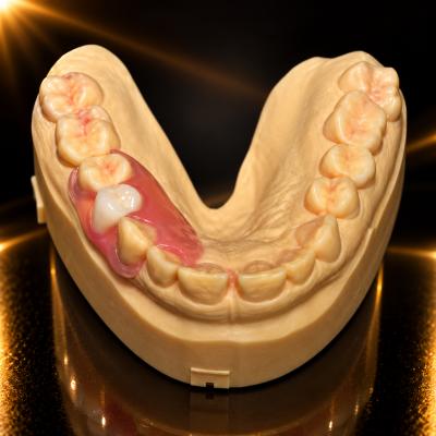 China Flexible Partial Denture Lab | Natural Look TCS Flexible Denture Stain Resistant BPA Free for sale
