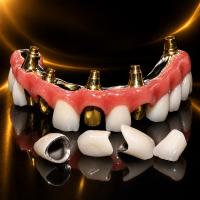 Quality Digital Dental Solutions Lab | AOX Class I All On 4 Dental Implants Hybrid for sale