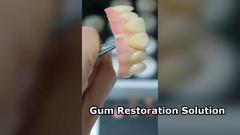Add Pink Gum Porcelain