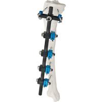 China Condylar External Fixation Device for sale