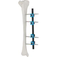 China Condylar External Fixation Device for sale