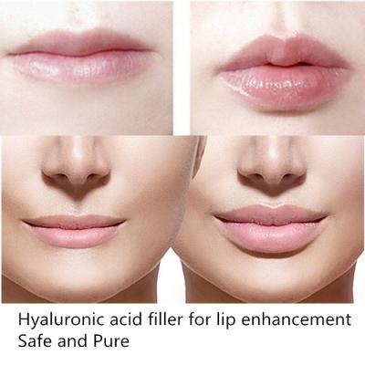 China Plump Lips Implant of Hyaluronic Acid Gel Injection 2ml of Derm Deep Kind for sale