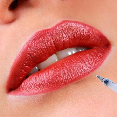 China Hyaluronic Acid Injection Filler for Lips Enhancement 2ml of Derm Deep Kind for sale