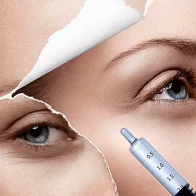 China Safe Pure Hyaluronic Acid Gel Filler Injection for Removing Glabellar Frown Lines for sale
