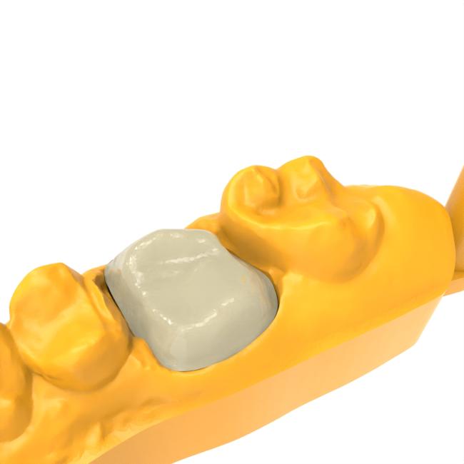 "High-performance nano-ceramic powder permanent crown resin - excellent wear resistance and natural aesthetic effect"