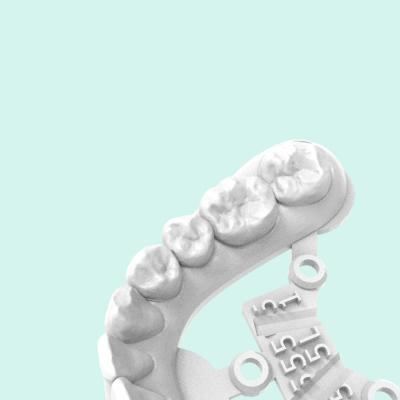 China Orthodontic Model Fast Curing Resin White Dental 3d Printer Resin for sale