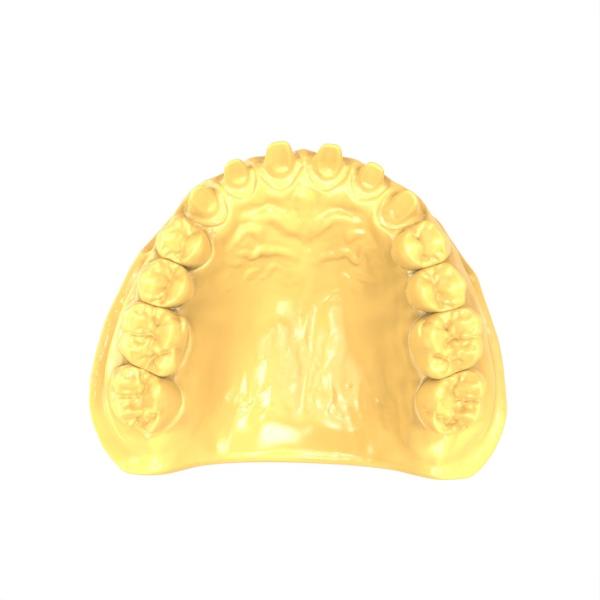 Quality Dental Model Repair Biocompatible Resin Kit ASTM D2204 Safe And Effective for sale