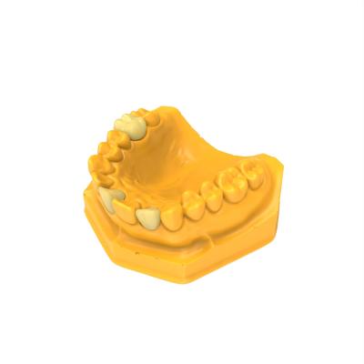 China Durable Permanent Crown Bridge Resin Long-Lasting Performance Service Life for sale
