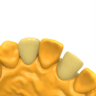 China Durable Permanent Crown Bridge Resin Long-Lasting Performance Service Life for sale
