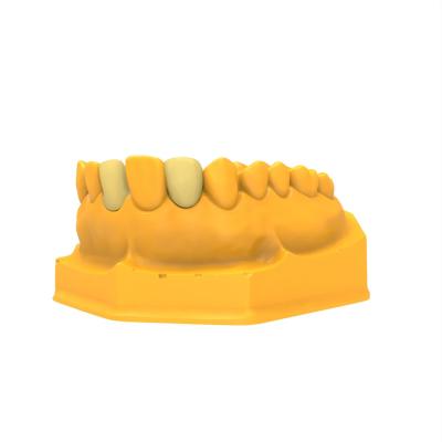 China Durable Permanent Crown Bridge Resin Long-Lasting Performance Service Life for sale
