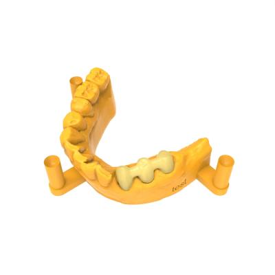 China 80C Hot Deformation Resistant Permanent Crown Bridge Resin for Longevity for sale