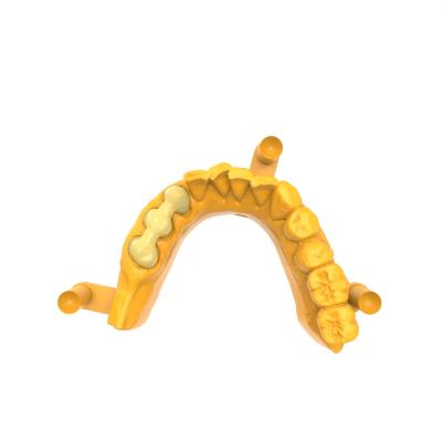 China 80C Hot Deformation Resistant Permanent Crown Bridge Resin for Longevity for sale