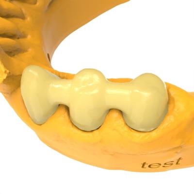 China 80C Hot Deformation Resistant Permanent Crown Bridge Resin for Longevity for sale