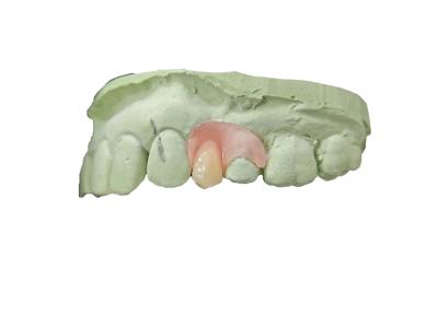 China Unsichtbare Zahnersatzbasis-Harz reduziert Fehler in der traditionellen Produktion mit 3D-Druck zu verkaufen