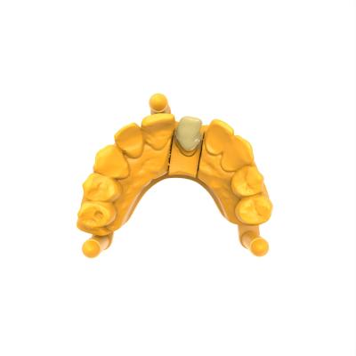 China Lightweight Permanent Crown Resin High Durability and Superior Mechanical Properties for sale