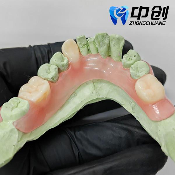 Personalizzazione soddisfa il comfort Protesi invisibile resina trasparente con design ergonomico