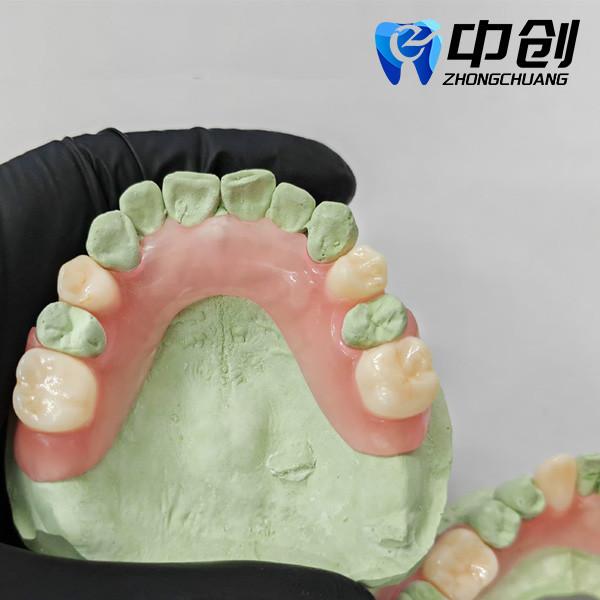 Personalizzazione soddisfa il comfort Protesi invisibile resina trasparente con design ergonomico
