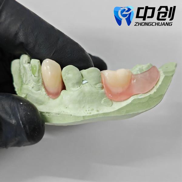 Personalizzazione soddisfa il comfort Protesi invisibile resina trasparente con design ergonomico