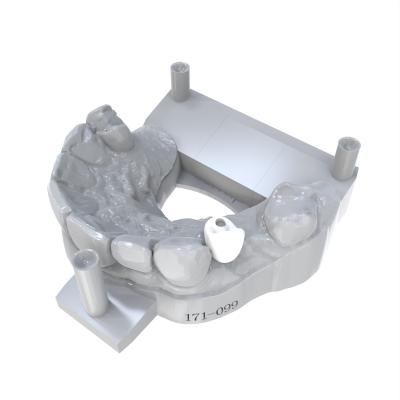 China Zhongchuang Medicals Resin Permanent Crown Materials The Perfect Blend Of Synthetic Resin And Ceramic Components for sale