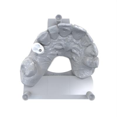 China Zhongchuang Medicals Resin Permanent Crown Materials The Perfect Blend Of Synthetic Resin And Ceramic Components for sale