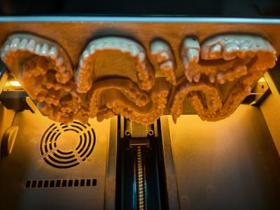 China Opposite Jaw Model Long Shelf Life​​ 3D Dental Model Resin Micron-level Resolution​ for sale