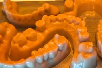 China Model Resin Dental Rigorous Safety Certification Non-toxic Biocompatibility Direct Intraoral Application for sale