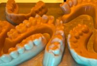 China Model Resin Dental Solid Shape Retention Post-cooling Enhanced Durability for sale