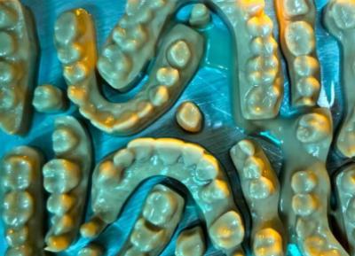 China Dental Model Resin Shore D 72 Bending Strength 75Mpa Precision Grade Stability for sale