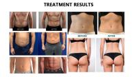 China 360 Cryolipolysis Cryo Sculpting Machine for sale